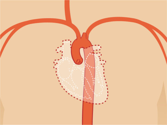 Anatomie, fonction et diagramme de la veine axillaire - santemedicals.com