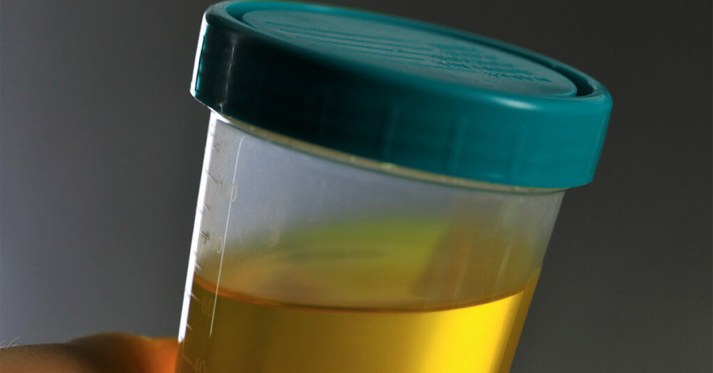 Combien de temps la méthamphétamine reste-t-elle dans votre urine ? vs ...