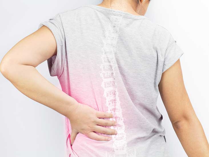 Dessiccation Du Disque : Symptômes, Causes Et Traitement ...