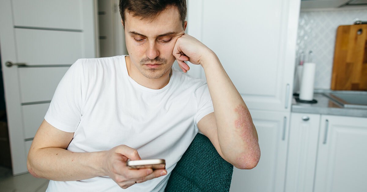 Symptômes, Images, Traitement Et Plus Encore - Santemedicals.com