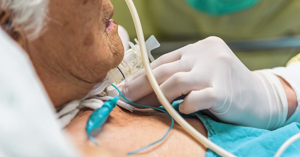 Directives D'aspiration De La Trachéotomie - Santemedicals.com