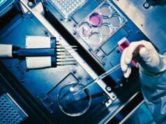 Le Test D-dimère : Ce Qu'il Faut Savoir - Santemedicals.com