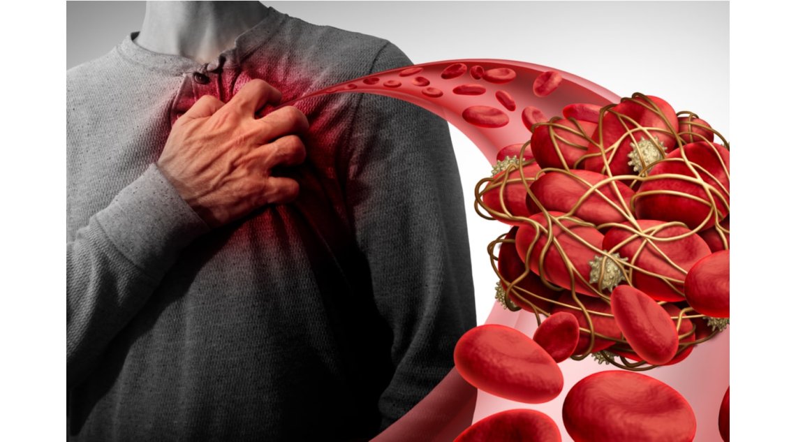 Anticoagulants Naturels : Qu'est-ce Que C'est Et Lesquels Sont Les Plus ...